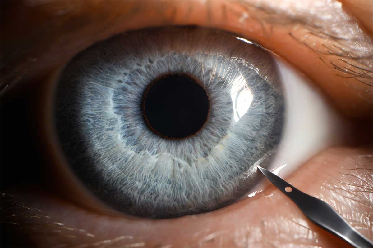 5G Technology's Ground breaking Impact on Healthcare: Remote Robotic ...